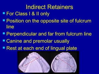 26. designing of rpd | PPT