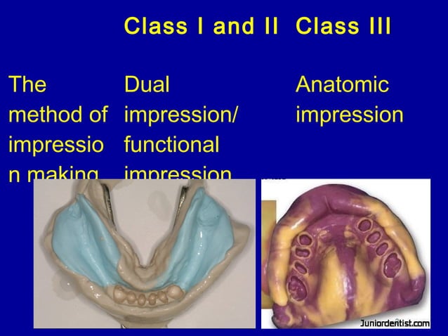 26. designing of rpd | PPT | Dental Health | Diseases and Conditions