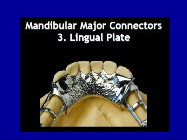 26. designing of rpd