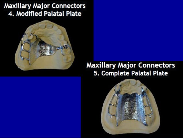26. designing of rpd