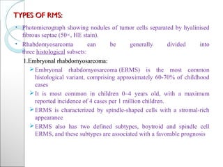 RHABDOMYOSARCOMA (MALIGNANT TUMOR) | PPT
