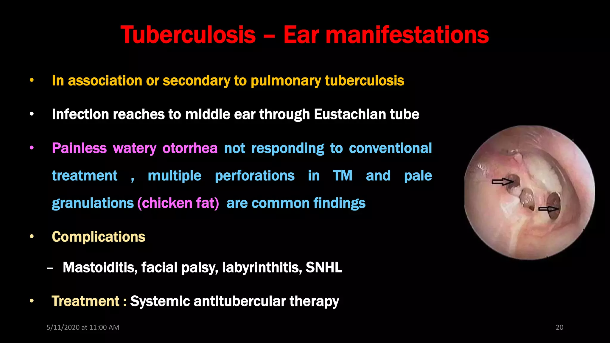 Otolaryngological manifestations of systemic diseases | PPTX