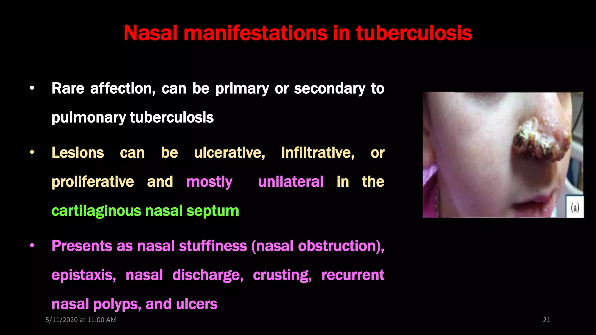 Otolaryngological manifestations of systemic diseases | PPTX