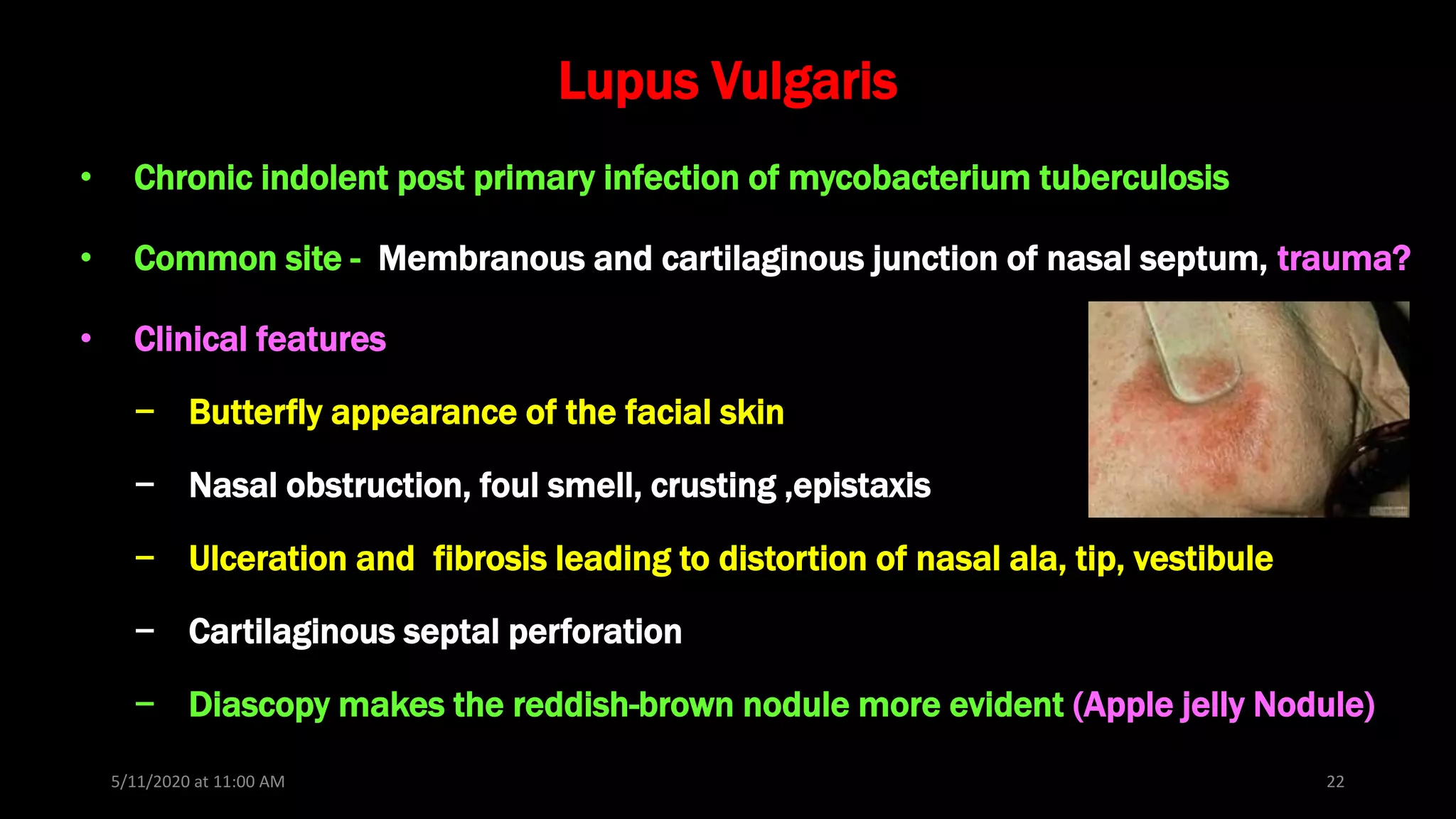 Otolaryngological manifestations of systemic diseases | PPTX