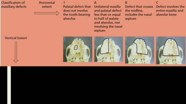 Maxillofacial Reconstruction | PPTX | Dental Health | Diseases and ...
