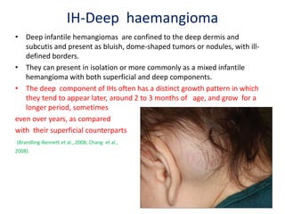vascular anomalies of newborn,approach to infantile hemangioma | PPT