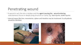 26.Wound classification, healing & Management.pptx