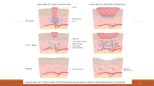 26.Wound classification, healing & Management.pptx
