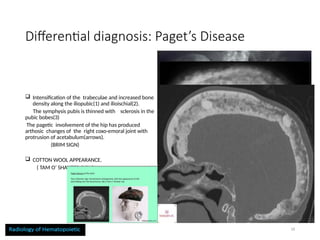 26. HEMOGLOBINOPATHIES for hematology.pptx