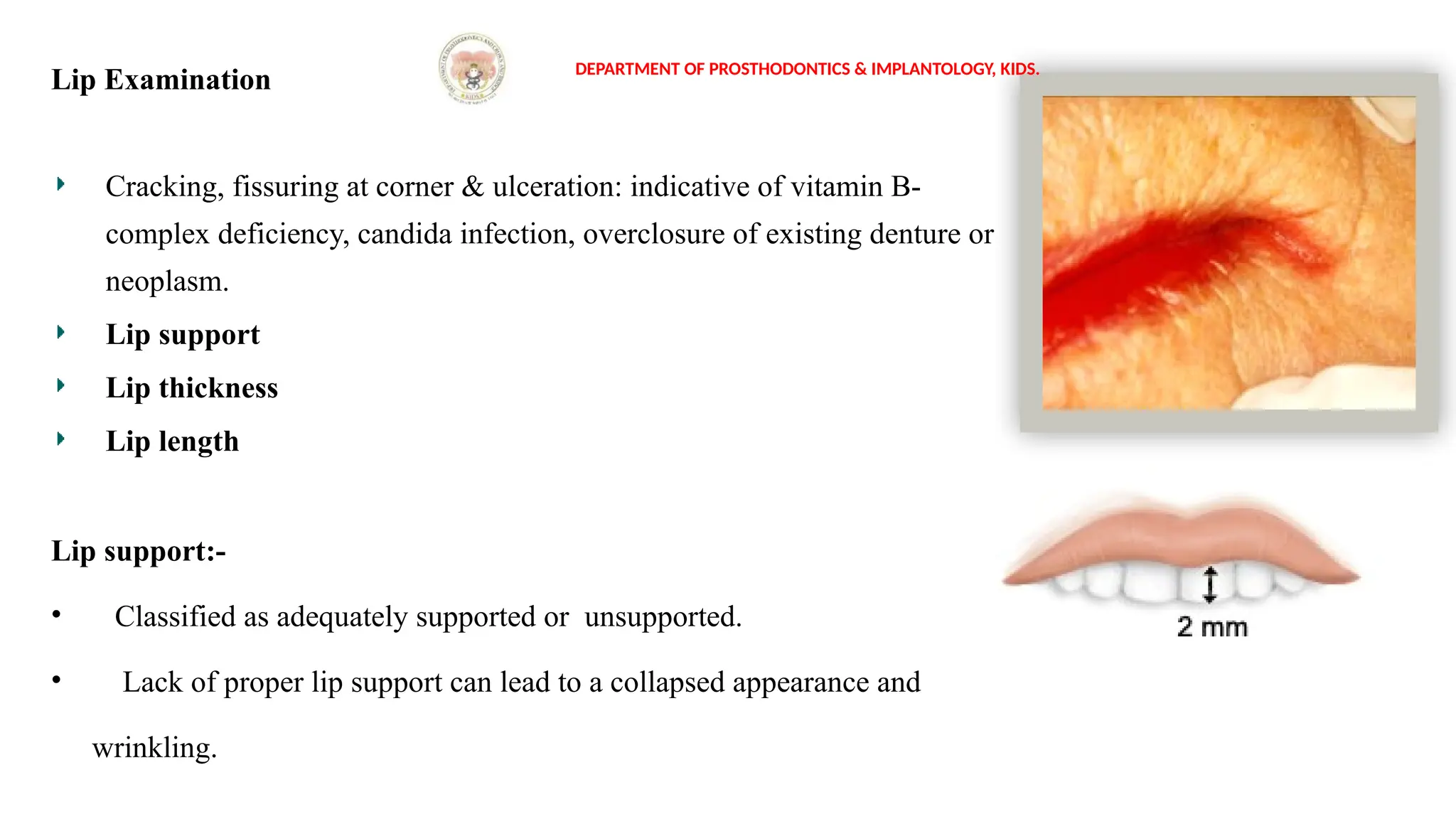 26.Diagnosis and treatment planning in complete denture final.pptx