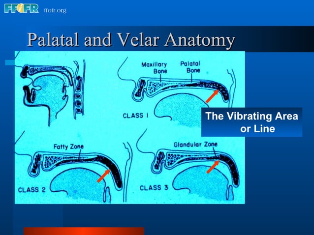 26.posterior palatal seal | PPT