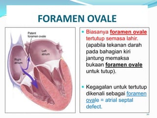 26. sirkulasi fetal | PPSX