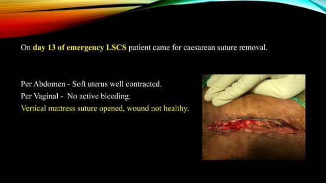 Why Wound Gape ? - Optimising Post Surgical Wound Healing | PPTX