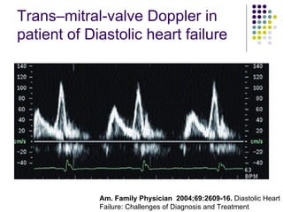 Diastolic Heart Failure | PPT