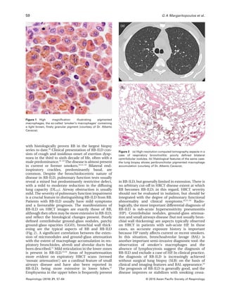 Smoking related idiopathic interstitial pneumonia a review 2016 | PDF | Smoking Cessation | Wellness