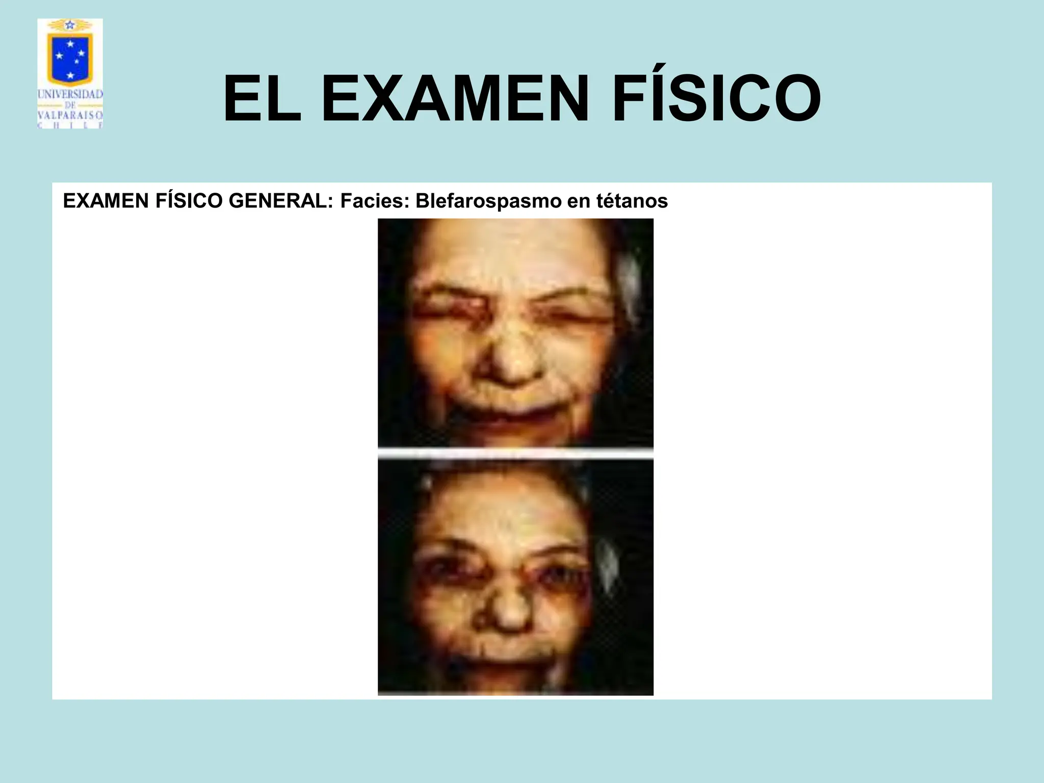 Tema 2 : D iapo Examen Fisico General.ppt