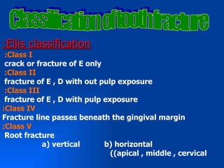 dento – alveolar injuries | PPT