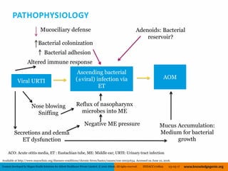 261_Acute_otitis_media.pdf