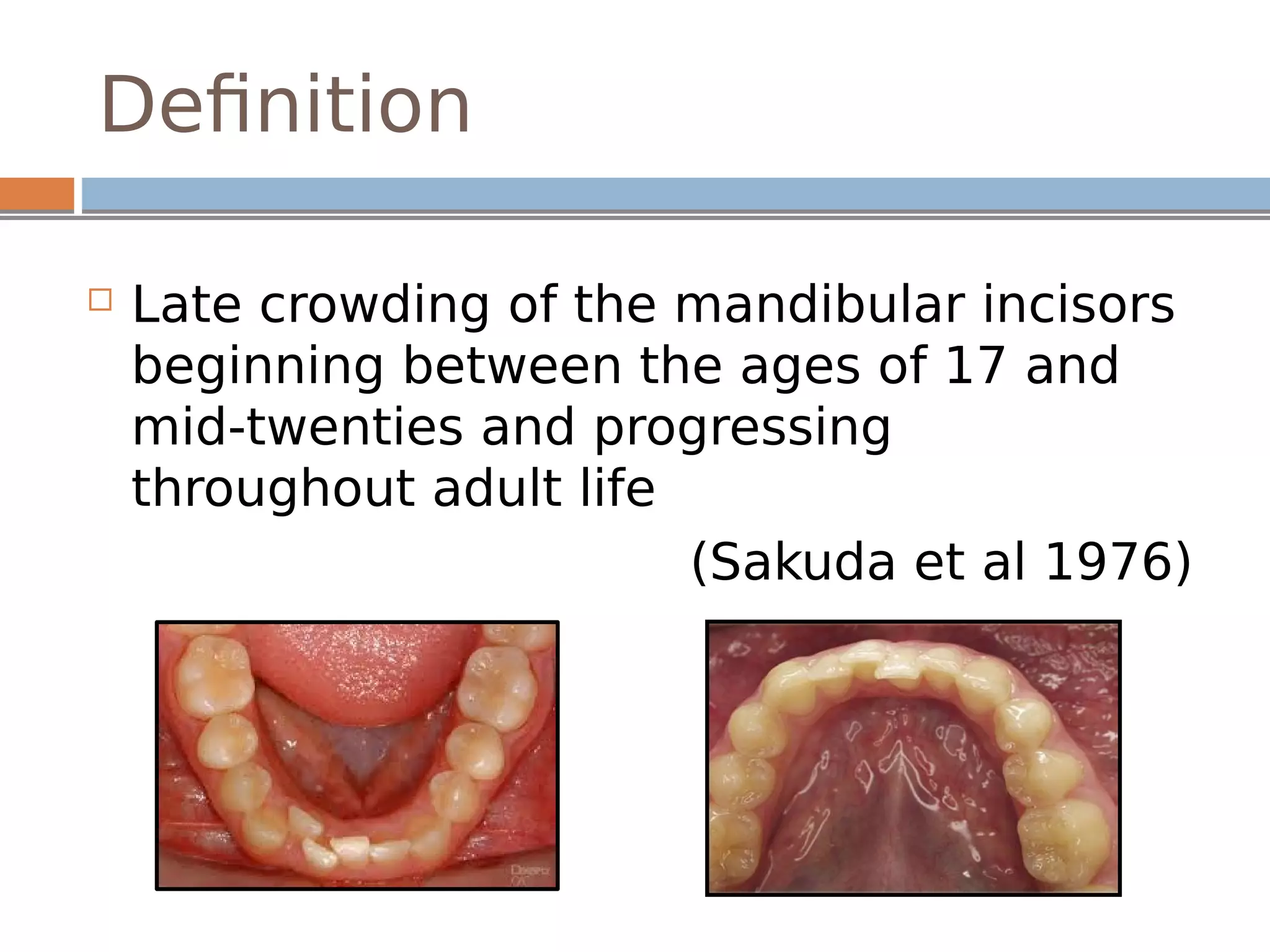 262054548-Late-Lower-Incisor-Crowding.pdf