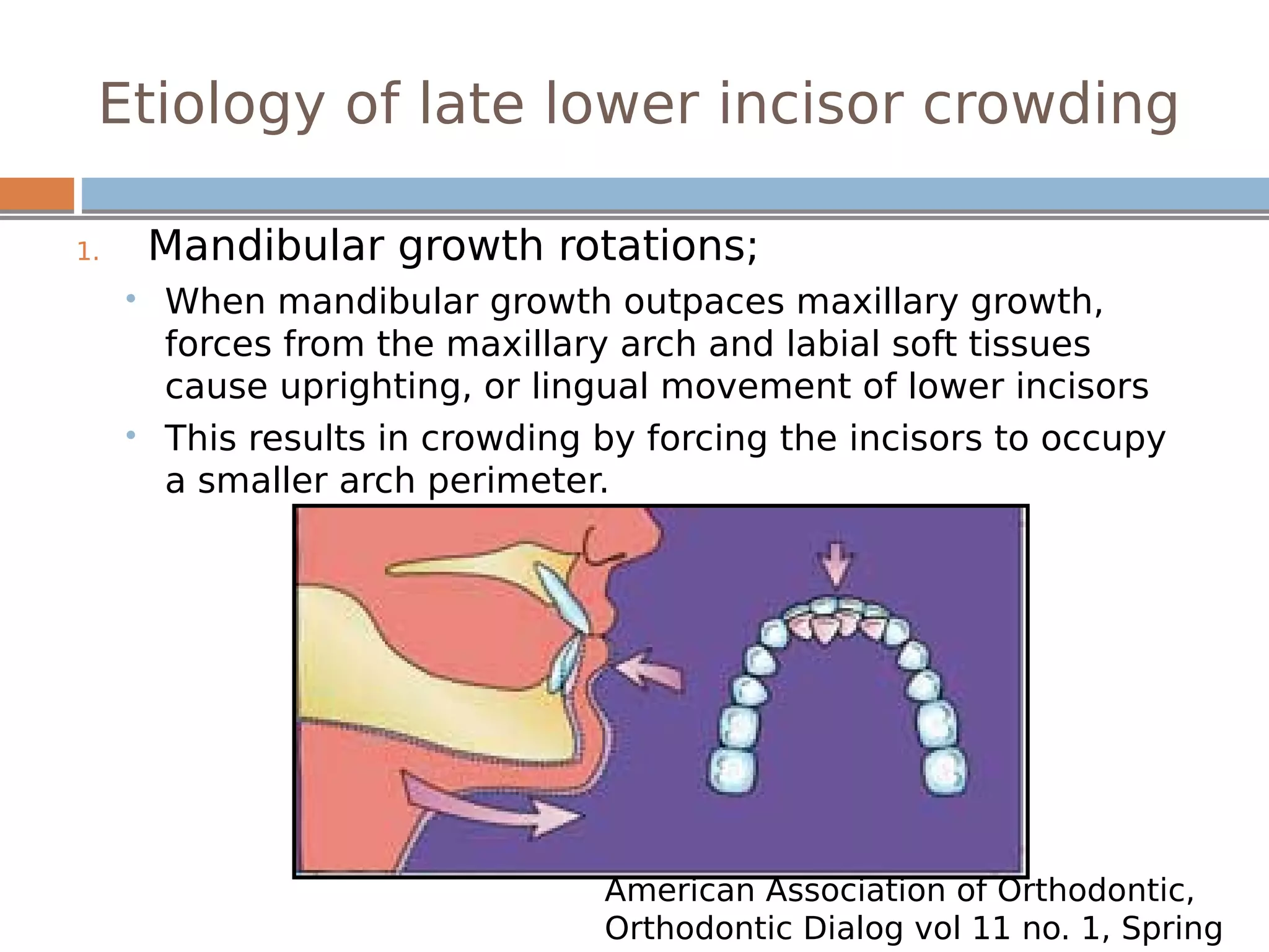 262054548-Late-Lower-Incisor-Crowding.pdf
