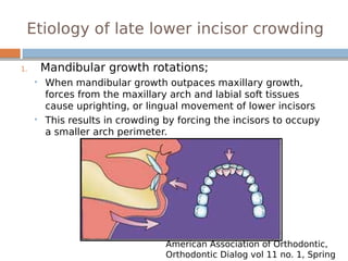 262054548-Late-Lower-Incisor-Crowding.pdf