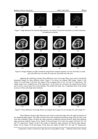 Comparative studies of multiscale edge detection using different edge ...
