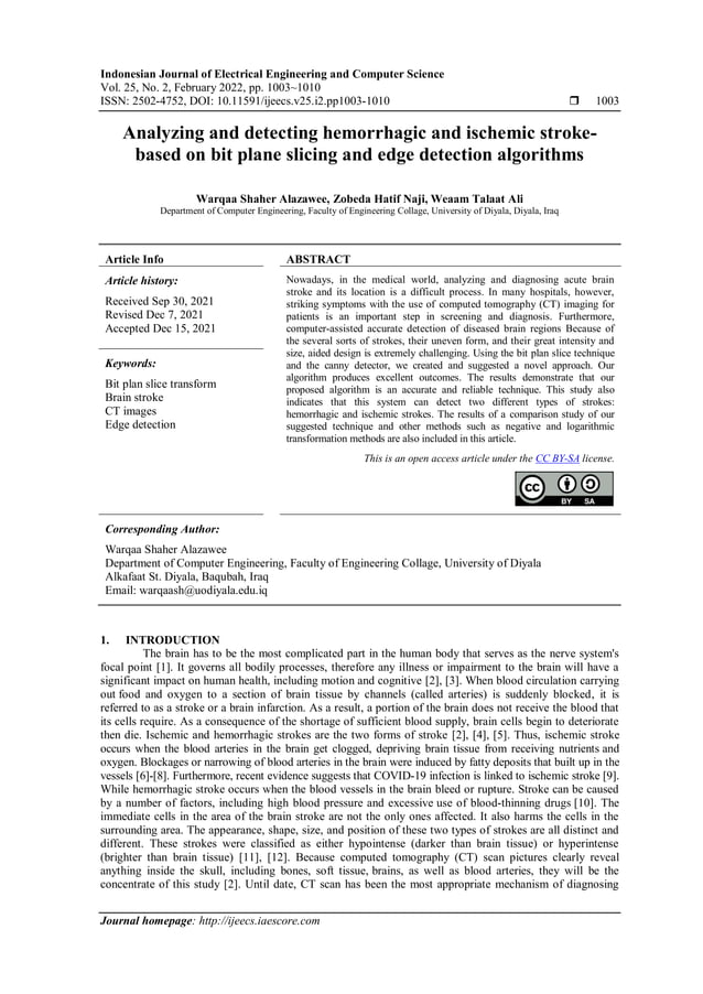 Analyzing and detecting hemorrhagic and ischemic strokebased on bit plane slicing and edge ...