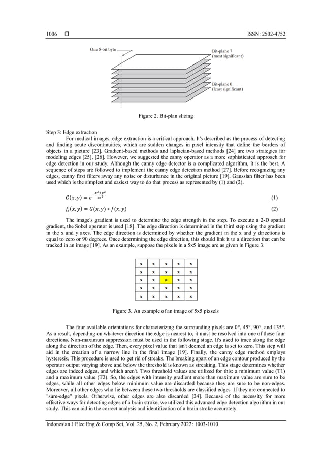 Analyzing and detecting hemorrhagic and ischemic strokebased on bit plane slicing and edge ...