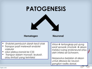 encephalitis | PPT