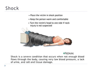 266169646-anaphylactic-shock-lecture-ppt (1).pptx
