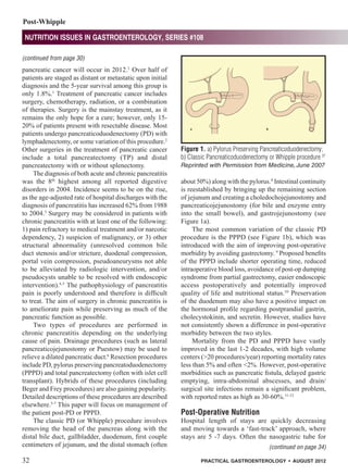 post whipple pancreatodeodenectomy nutrition -Management.pdf