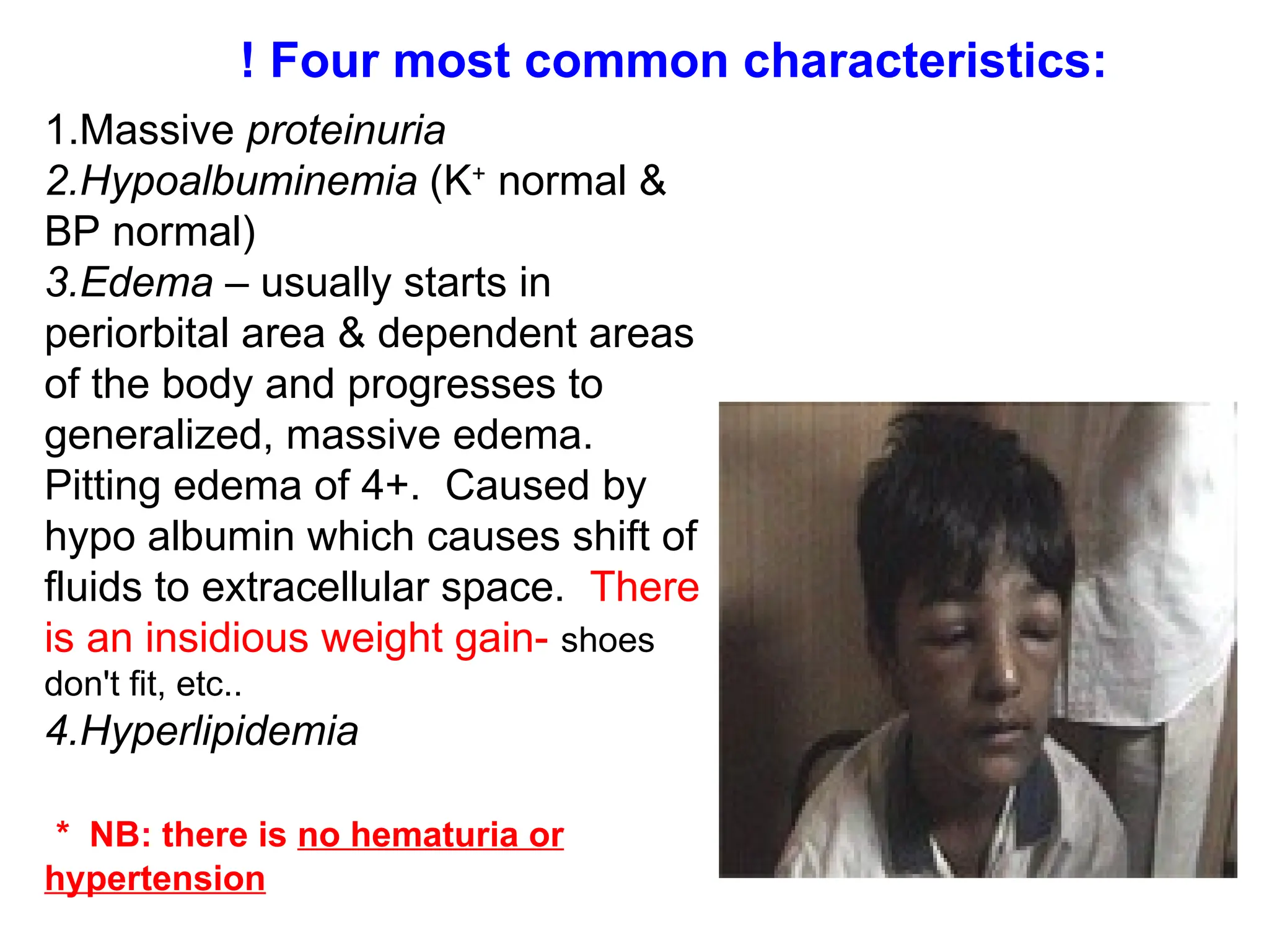266458167-Nephrotic-Syndrome-Notes and .ppt