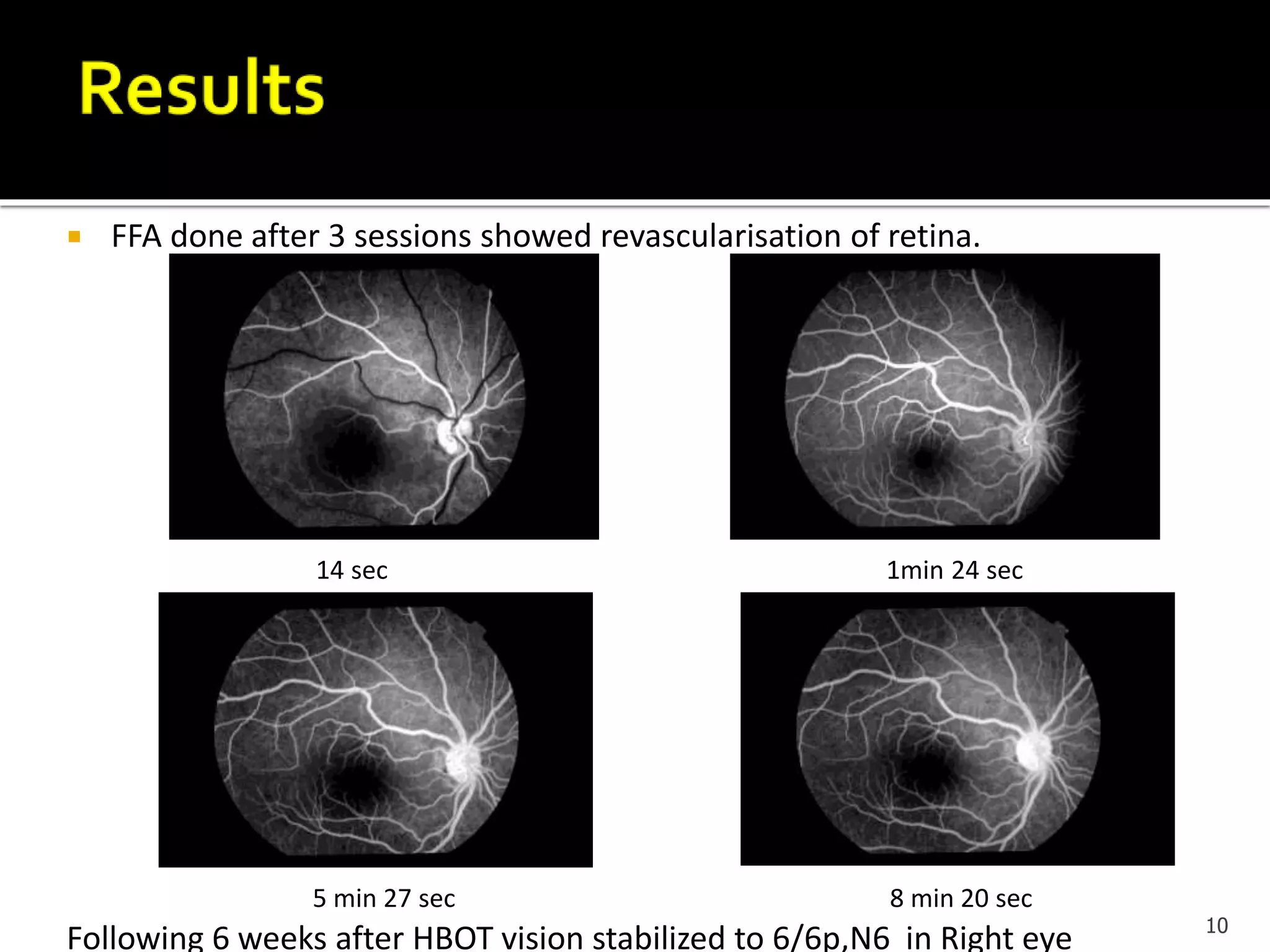 Recovery Of Vision In A Young Patient With Central Retinal Artery ...