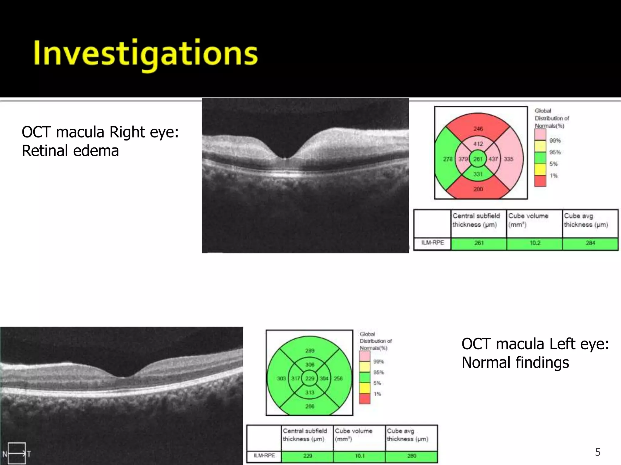 Recovery Of Vision In A Young Patient With Central Retinal Artery ...