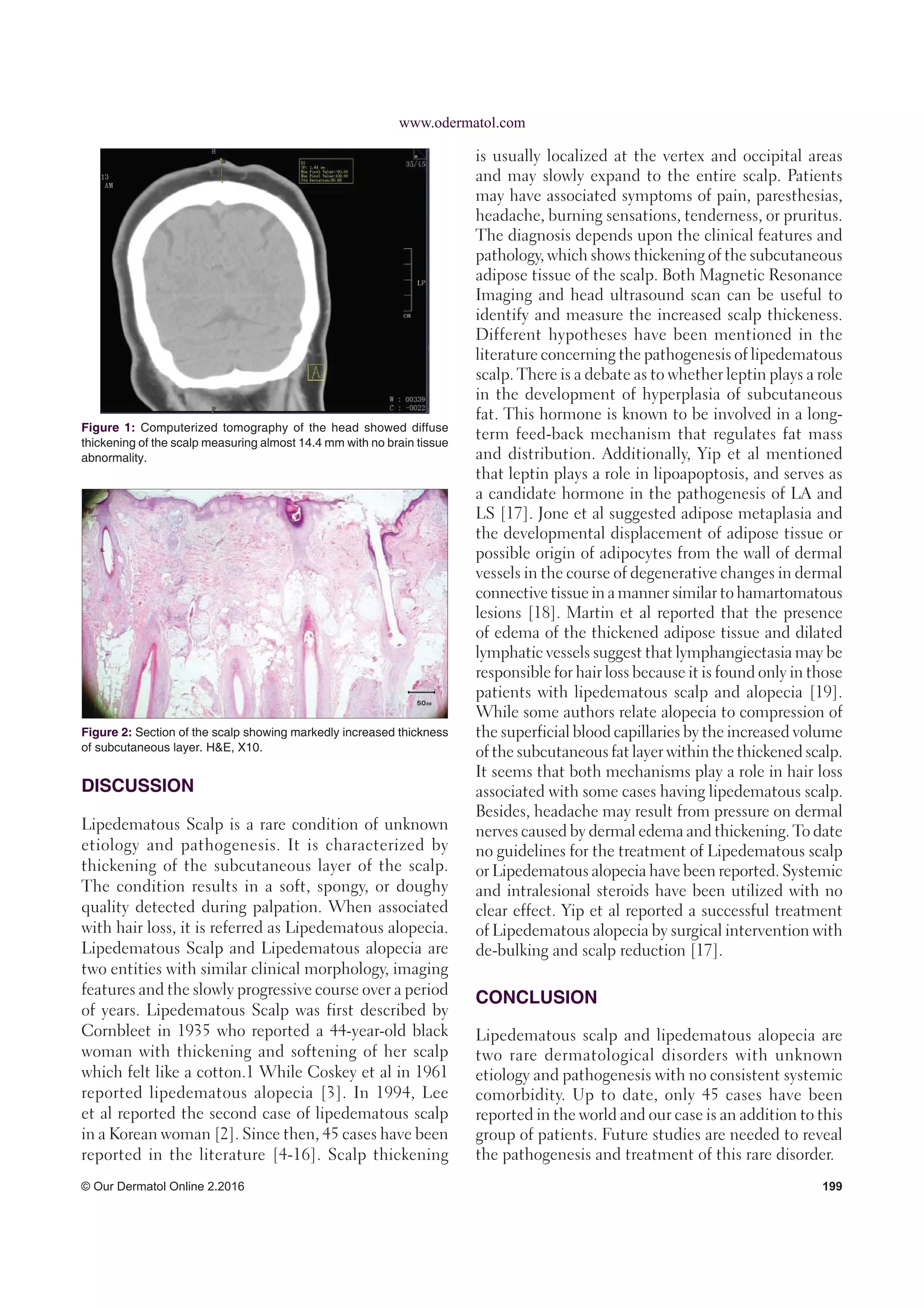liped-scalp copy | PDF