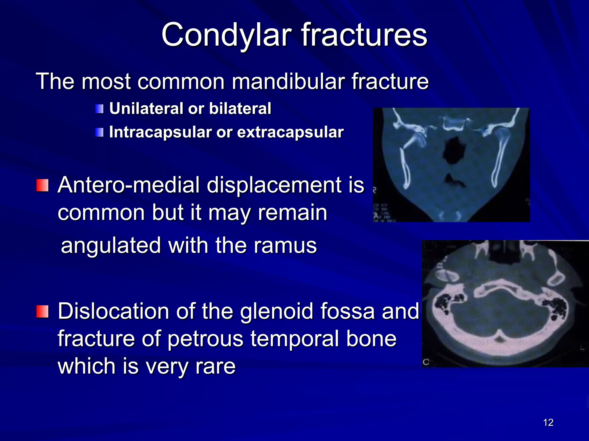 268307418-Management-of-Mandibular-fractures-ppt.ppt