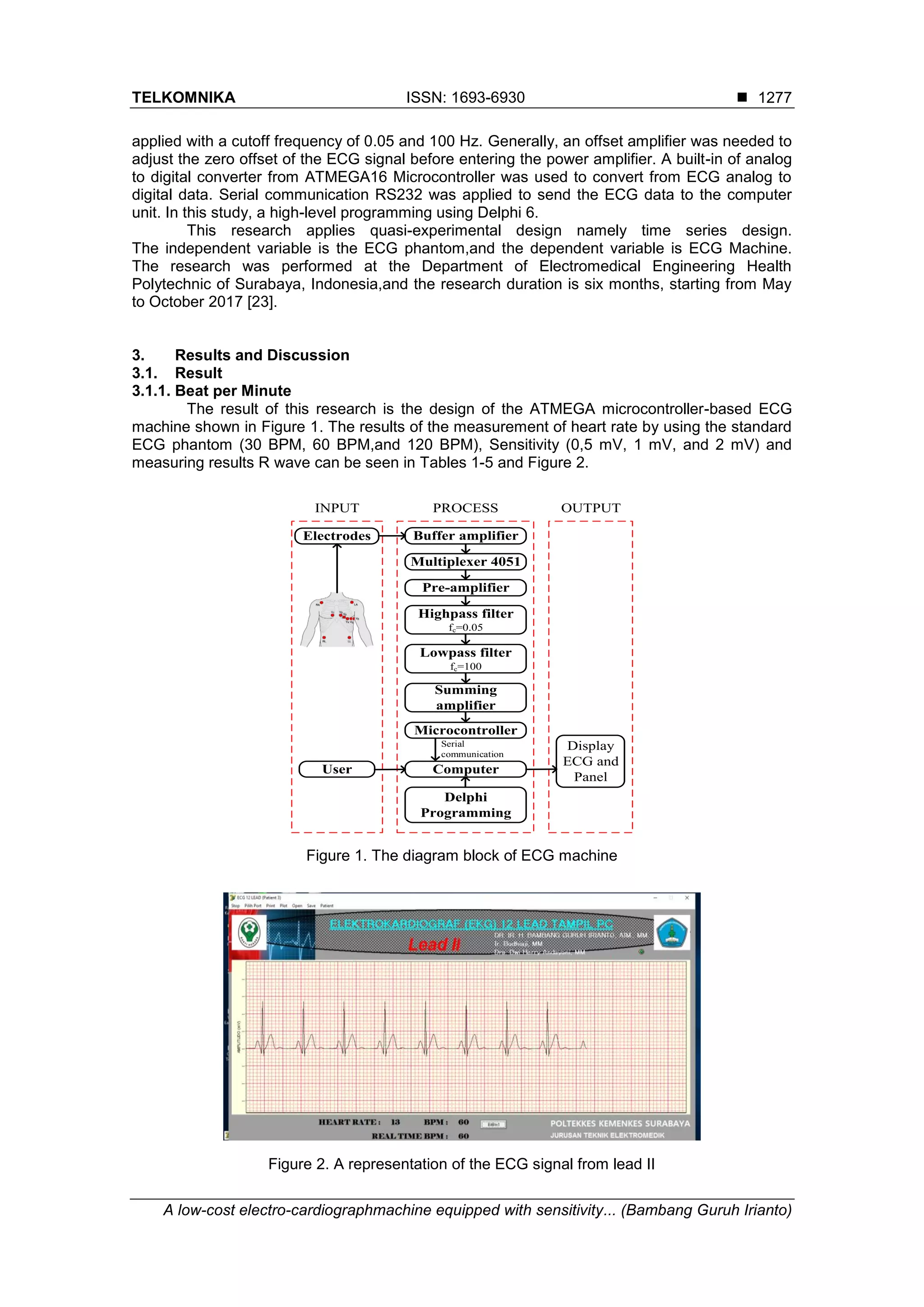 A low-cost electro-cardiograph machine equipped with sensitivity and ...