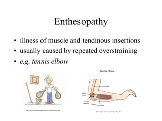 268_generral_anatomy_muscular_system.ppt