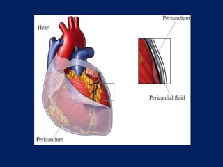 Pericardium | PPT