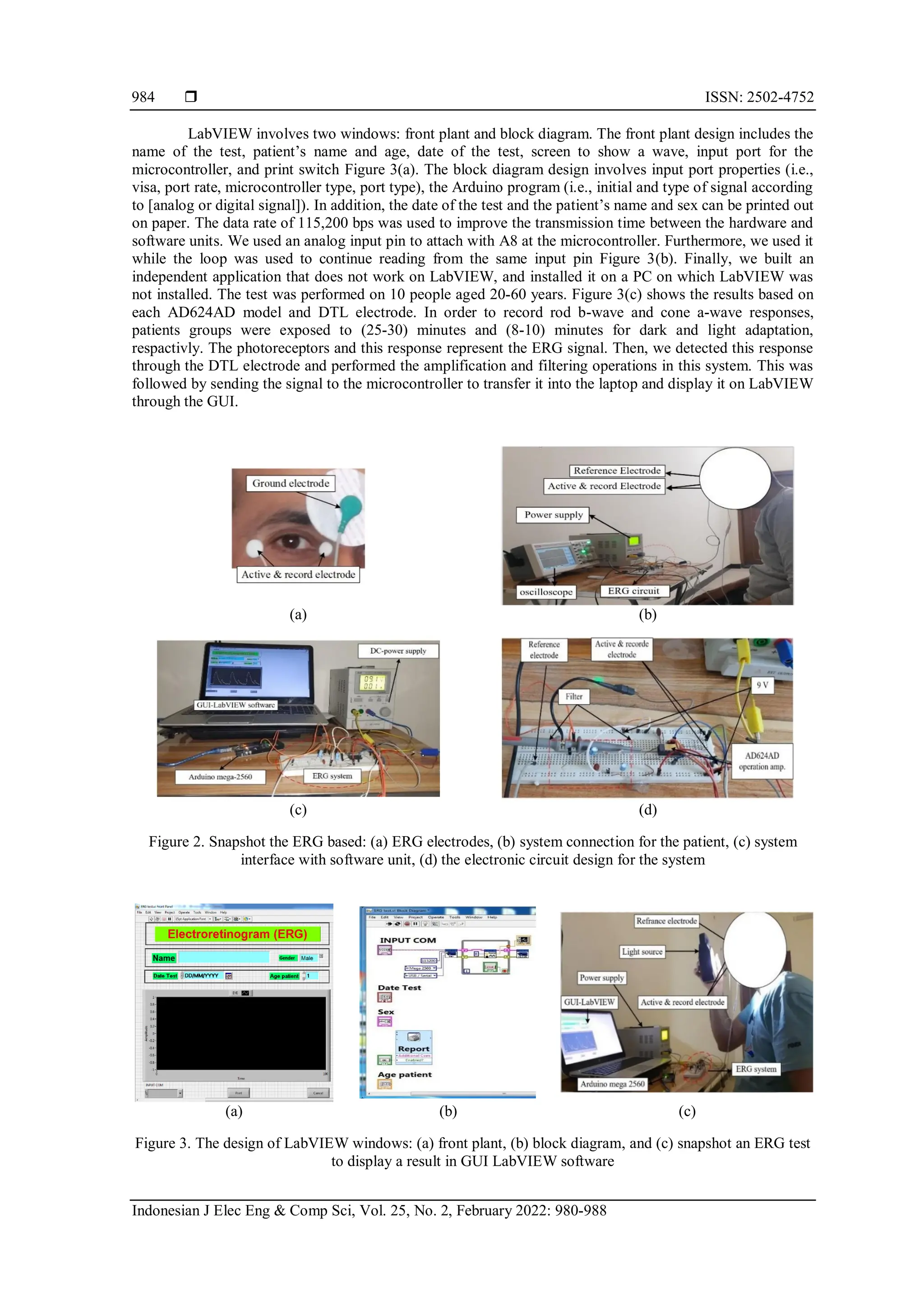 Measurement of an electroretinogram signal and display waves on ...