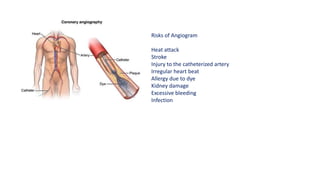 26 Angiogram.pptx