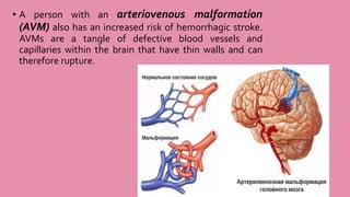 26e959e7_brain anatomy and cerebrovascular_diseases . | PDF