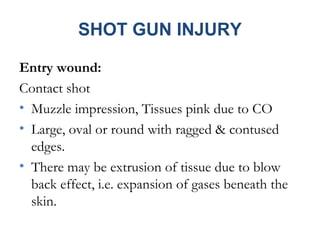 26 f wound balistics 26 | PPT