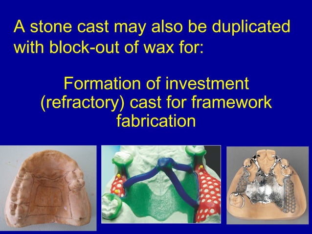 27. rpd lab procedures | PPT | Dental Health | Diseases and Conditions