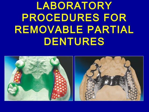 27. rpd lab procedures | PPT | Dental Health | Diseases and Conditions