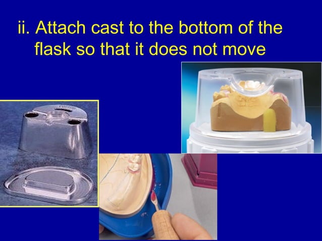 27. rpd lab procedures | PPT | Dental Health | Diseases and Conditions