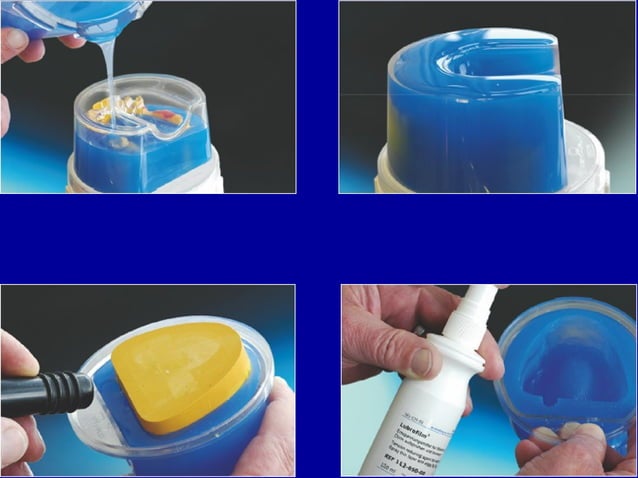 27. rpd lab procedures | PPT | Dental Health | Diseases and Conditions