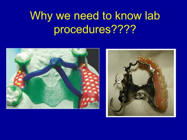 27. rpd lab procedures | PPT | Dental Health | Diseases and Conditions