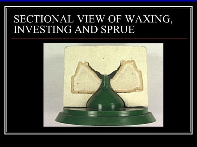 27. rpd lab procedures | PPT | Dental Health | Diseases and Conditions