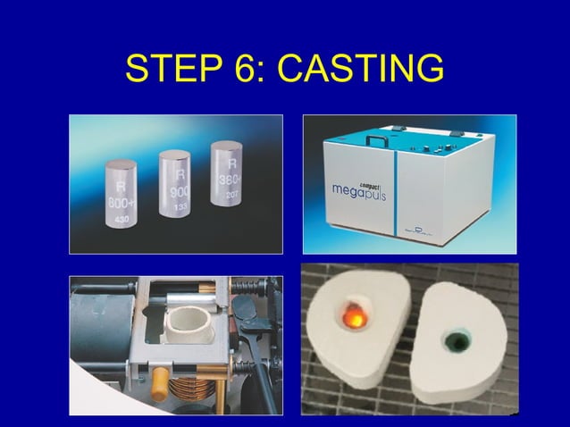 27. rpd lab procedures | PPT | Dental Health | Diseases and Conditions